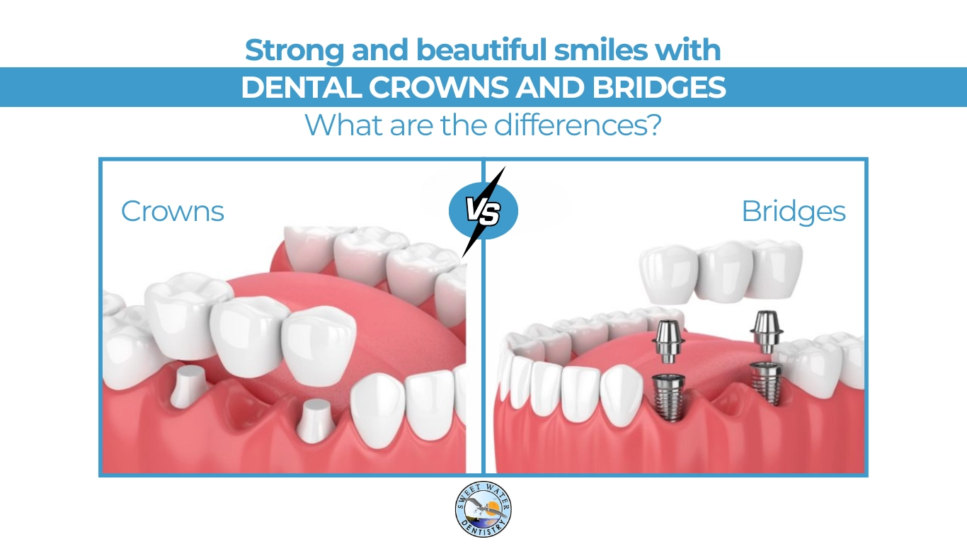 Crowns and Bridges - Restoring Your Smile with Confidence