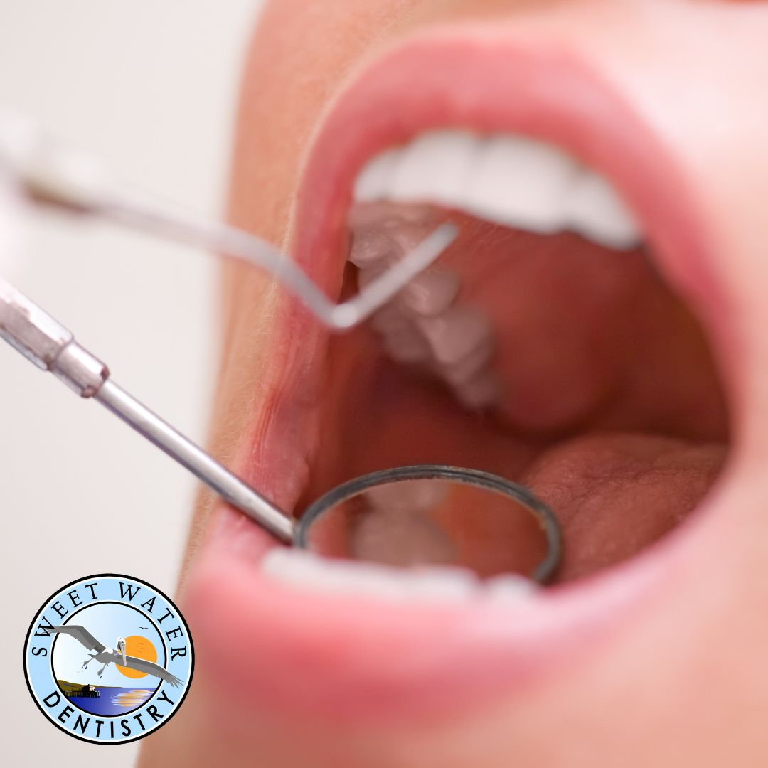 What are Ebner Glands? | Sweet Water Dentistry