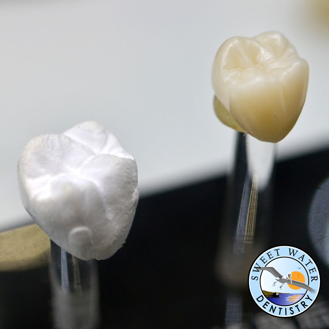 What Materials Are Dental Crowns Made From? A Comprehensive Guide ...
