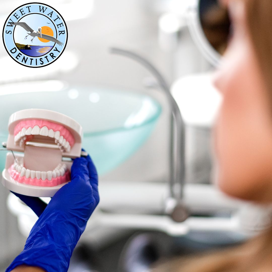 How Is a Dental Crown Placed? A Step-by-Step Guide | Dentist in ...